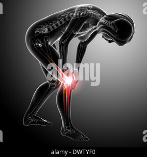 Knee pain woman drawing Stock Photo - Alamy
