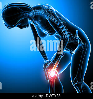Knee pain woman drawing Stock Photo - Alamy