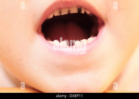 little girl's mouth without teeth Stock Photo - Alamy