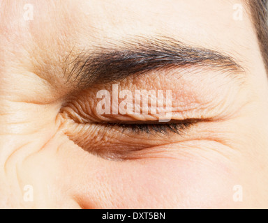 A Young Girl Squeezing Her Eyes Shut Stock Photo: 29315380 - Alamy