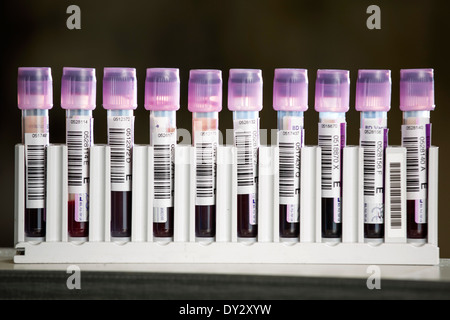 Blood sample bottles pictured in the blood testing lab at Heartlands ...