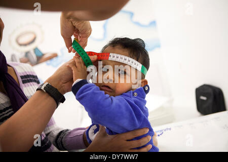 Measurement of the circumference of a 14-month-old baby's head (cranial ...