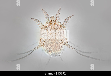 Scabies mite Sarcoptes scabiei, photomicrograph Stock Photo - Alamy
