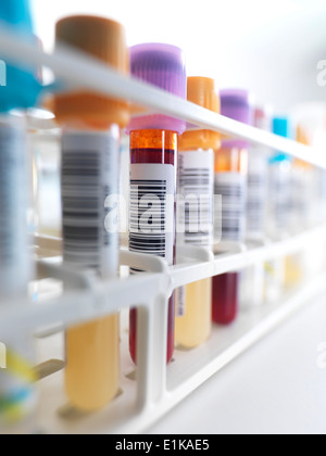 Blood samples, close up Stock Photo - Alamy