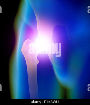 Hip joint close-up 3D rendering illustration isolated on white with ...