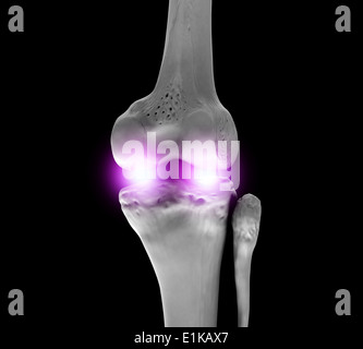 Human knee joint, computer artwork Stock Photo - Alamy