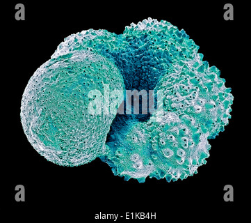 Globigerina foraminiferan Coloured scanning electron micrograph (SEM ...