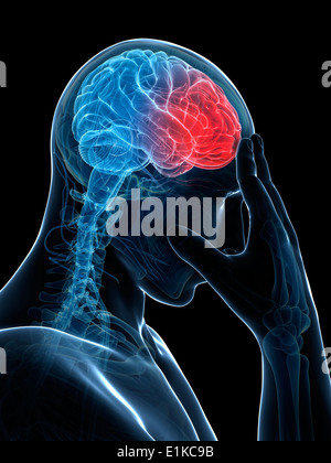 Headache computer artwork Stock Photo - Alamy