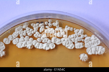 Colony of soil bacteria on an agar plate with rhizoid form Stock Photo ...