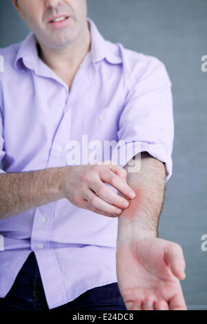 Itching in a man Stock Photo - Alamy