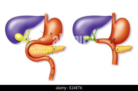 Liver, gallbladder pancreas duodenum and the bile passages Stock Photo ...