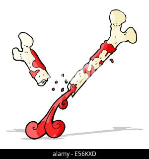 gross broken bone cartoon Stock Vector Image & Art - Alamy