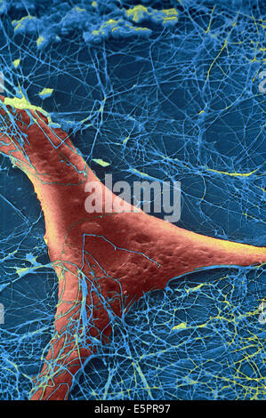 Collagen. Scanning electron micrograph (SEM) of collagen bundles from ...