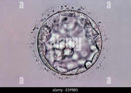 Oocyte, Light microscope Stock Photo - Alamy