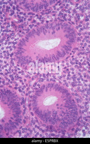 Normal endometrium cells, Light microscopy Stock Photo - Alamy