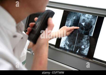 The hysterosalpingography or hysterography is an X-ray of the uterus ...