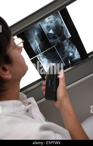 The hysterosalpingography or hysterography is an X-ray of the uterus ...