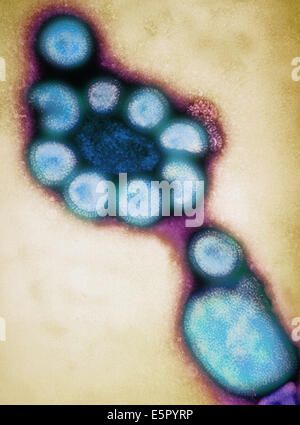 Colored transmission electron micrograph (TEM) of human papillomavirus ...