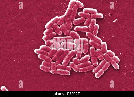 Scanning electron micrograph (SEM) of a Escherichia coli bacterium ...