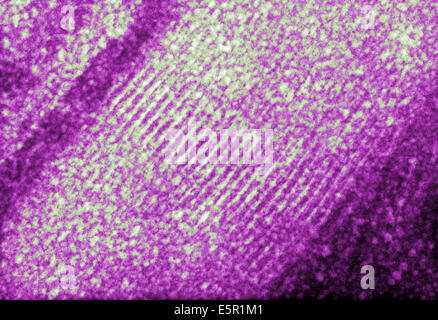 transmission electron micrograph of myelin sheath Stock Photo: 76787465 ...