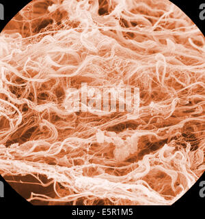 Collagen. Scanning electron micrograph (SEM) of collagen bundles from ...