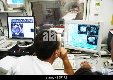 ExAblate® 2000 system with MR guided focused ultrasound uses a ...