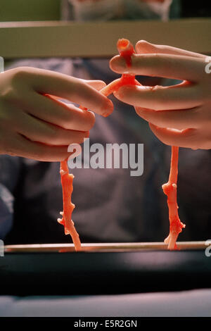 Human tissue bank, Saint Louis hospital, Paris, France, Preparation of ...