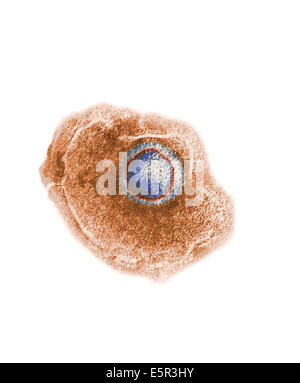 transmission electron micrograph of varicella zoster virions from ...