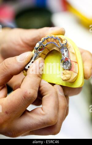 Fabrication of a denture-skeleton Stock Photo - Alamy