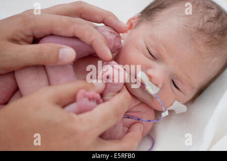 Pediatrician puts a premature newborn baby in fetal position to relax ...