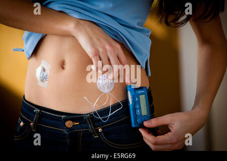 Programmable insulin pump administering insulin continuously through ...