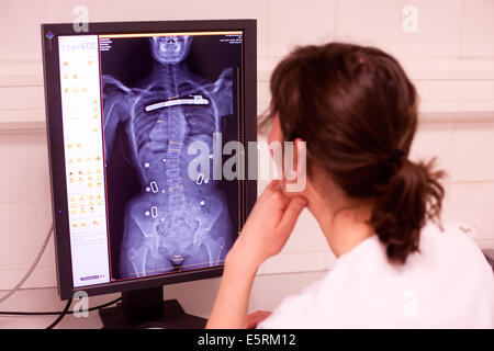 EOS biplanar X-ray scanner, this 2D and 3D digital X-ray imaging ...