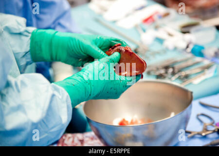 Partial removal of a liver from a living donor by laparoscopy for ...