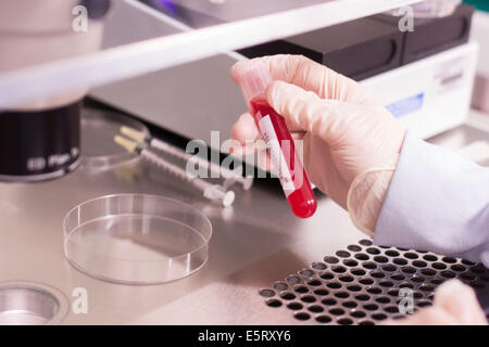 Collection of oocyte : tube of follicular fluid containing oocytes ...