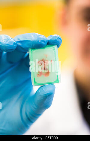 Anatomopathology diagnosis, Tenon hospital, Paris, France Stock Photo ...