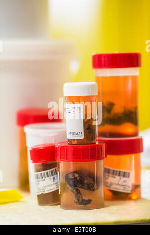 Anatomopathology diagnosis, Tenon hospital, Paris, France Stock Photo ...