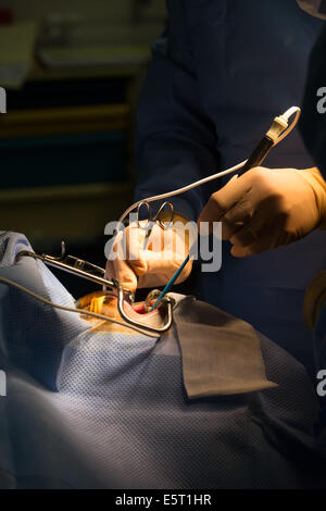 Treatment of snoring tonsillectomy (ablation of tonsils), her intern ...