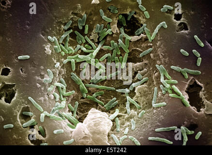 Scanning electron micrograph (SEM) of Mycobacterium leprae, Gram-positive, rod prokaryote ...