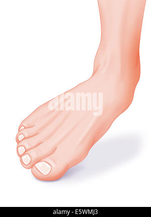 Sprained ankle, drawing Stock Photo - Alamy