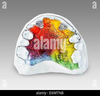 Multicolored and glittered upper orthodontic appliance with two z ...