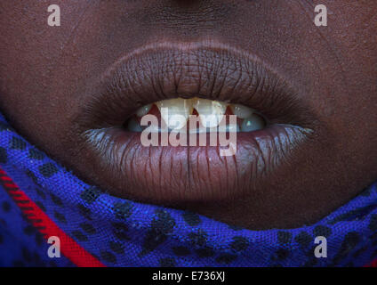Afar Tribe Woman With Sharpened Teeth, Assaita, Afar Regional State ...