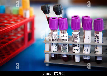 Rack of blood tubes with barcode labels for proper identification from ...