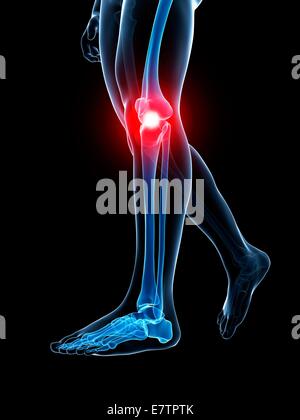 Human knee pain, computer artwork Stock Photo - Alamy