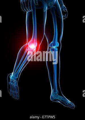 Human knee pain, computer artwork Stock Photo - Alamy
