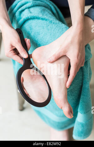 Detection of melanoma on the soles of the feet Stock Photo - Alamy