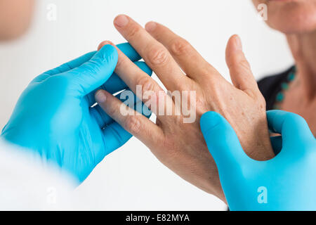 Contact dermatitis on finger Stock Photo - Alamy