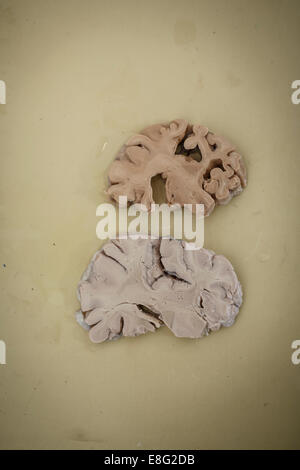 Human brain dissect for medical test dementia Stock Photo - Alamy