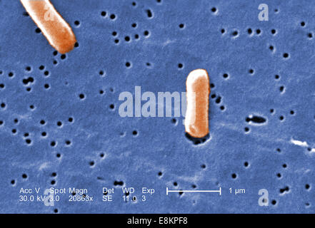 Scanning electron micrograph (SEM) of Salmonella typhimurium (red), a ...