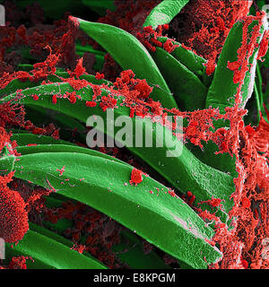 Scanning electron micrograph of Yersinia pestis, which causes bubonic ...