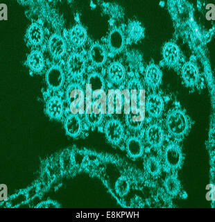 Highly magnified transmission electron micrograph (TEM) of a number of ...